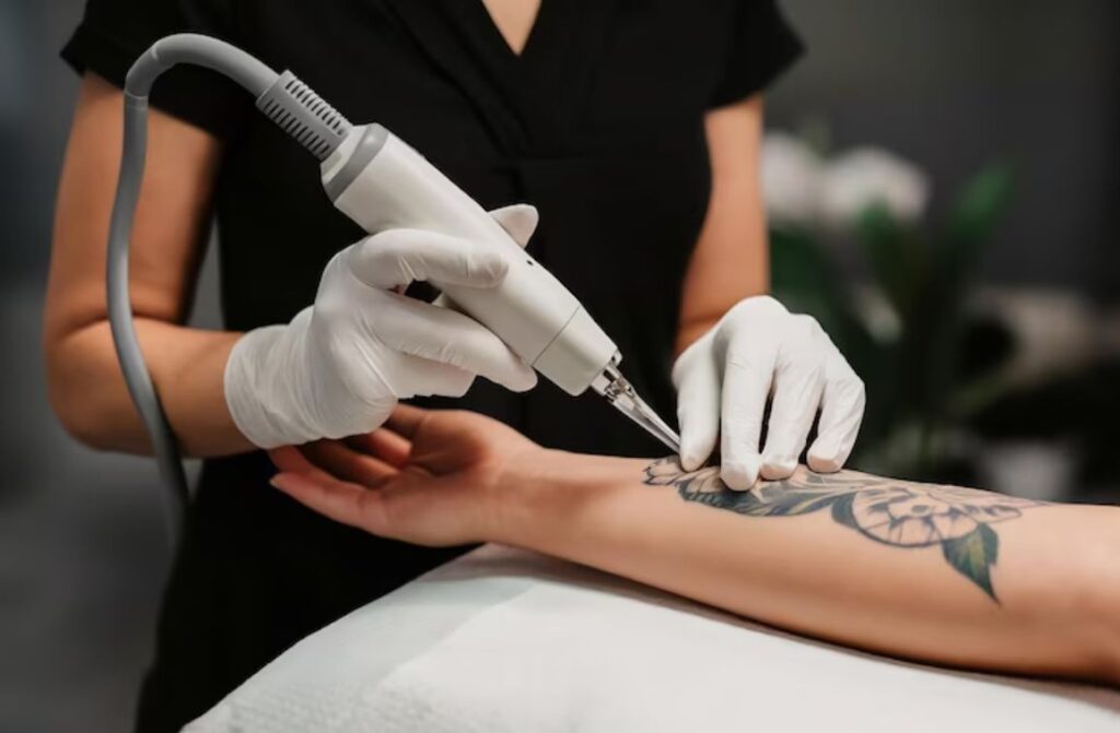 What is a Q-Switch laser treatment? How does it work? - Viara Clinics
